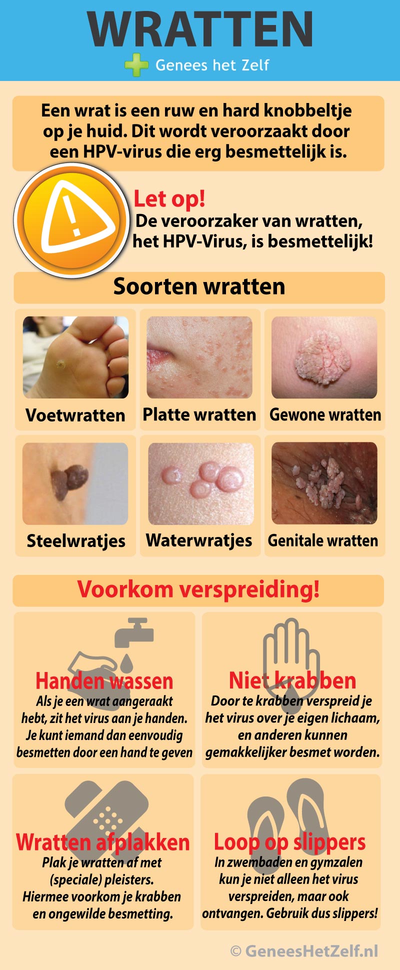 8 Tips om (Oudersdoms)Wratten te Verwijderen Op Natuurlijke Wijze